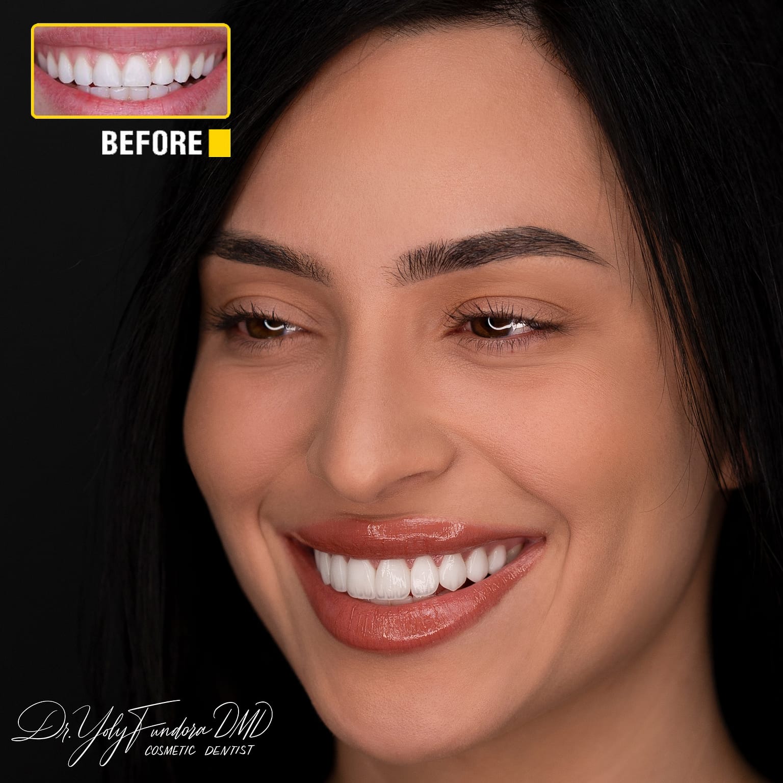 Smile Design Cosmetic Dentistry | Digital Dentistry Technology in Davie, FL