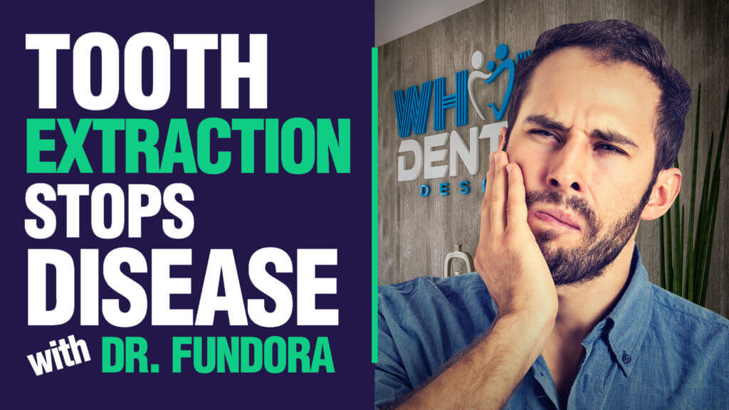 Tooth Extraction in Davie | Plantation, FL – Find Affordable Tooth ...